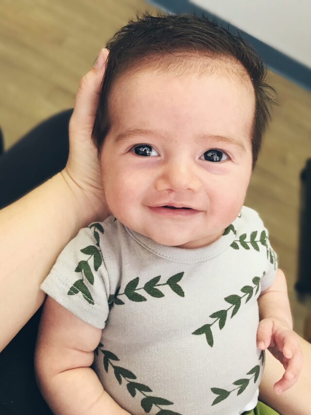 What Microform Cleft Lip Looks Like and How to Fix It - Oh Happy Play