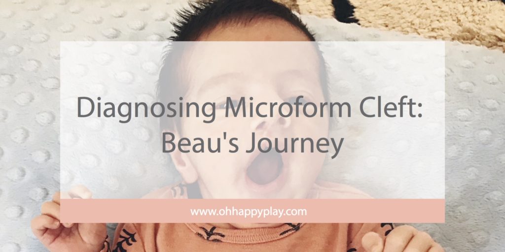 Diagnosing Microform Cleft: What to Look for and What It's Like