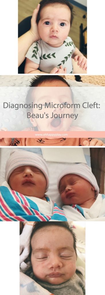 Diagnosing Microform Cleft: What to Look for and What It's Like